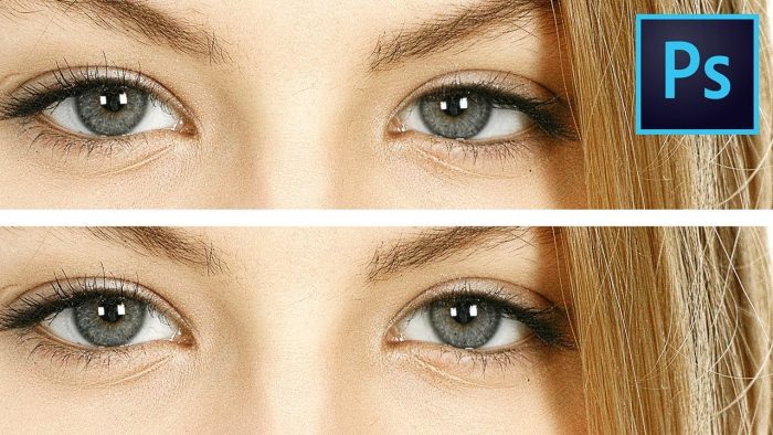 Lazy Eye in Pictures (Easy Fix Method)